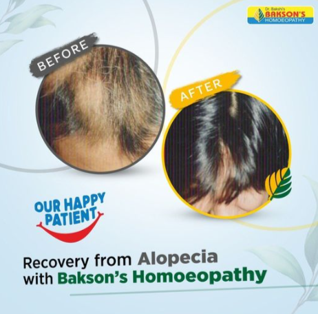 Homeopathic Doctors Near Me in Delhi/NCR, Allergies Remedies Products ...